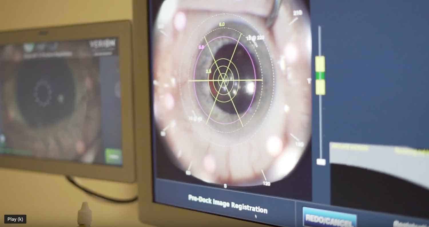 IOLs in Austin - Cataract Surgery Lens and Lenes Replacement