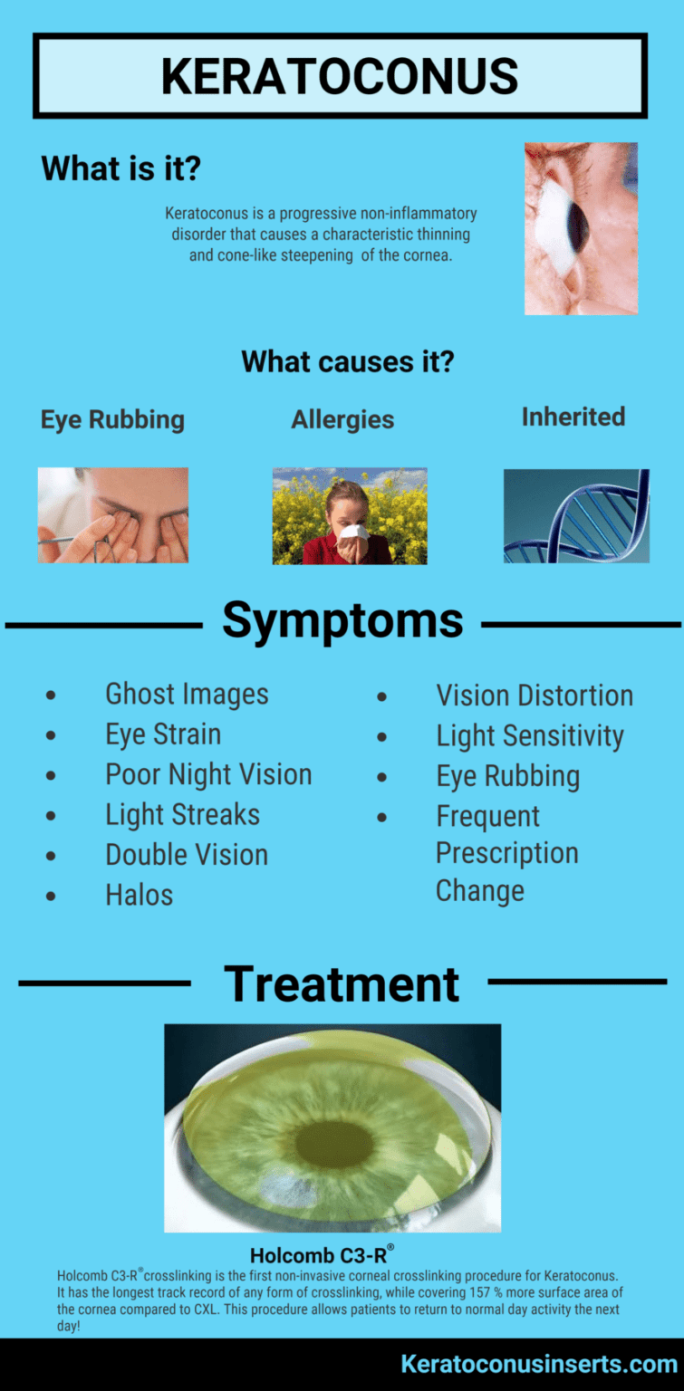 Keratoconus Symptoms and Treatments – Keratoconus – Eye Disease Causes