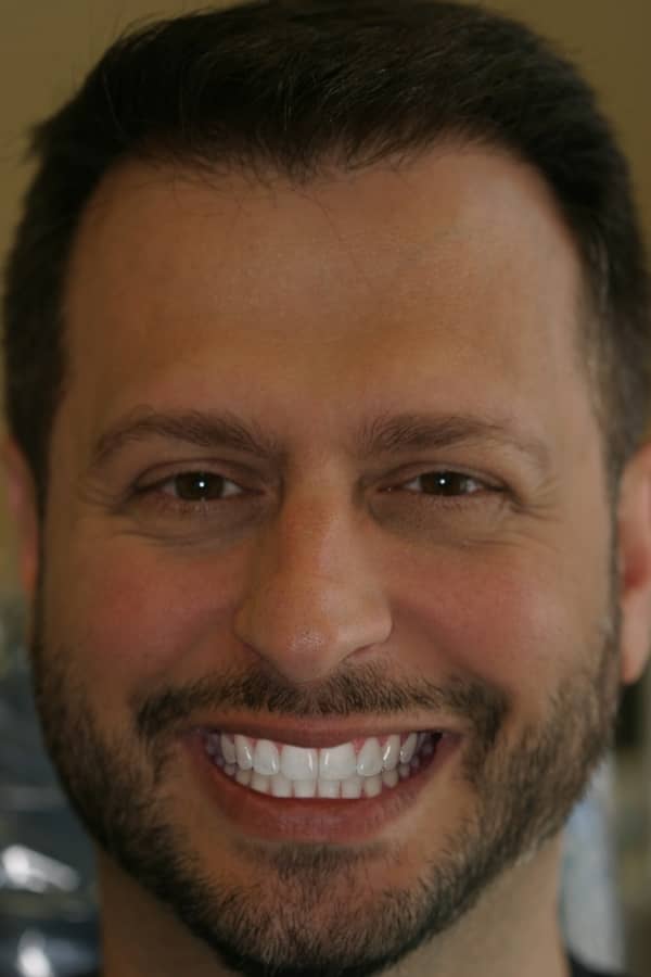 Sal G's Smile | New York, NY | New York Smile Institute