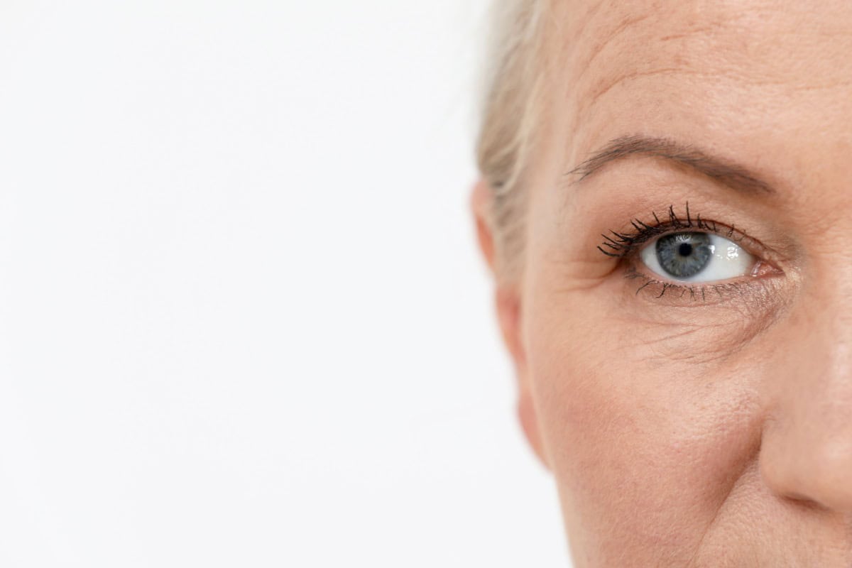 What to Expect During PRK Recovery